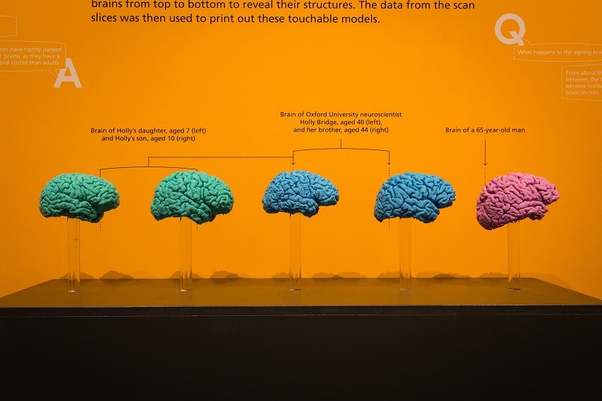 The Big Brain Competition – More Than A Dodo